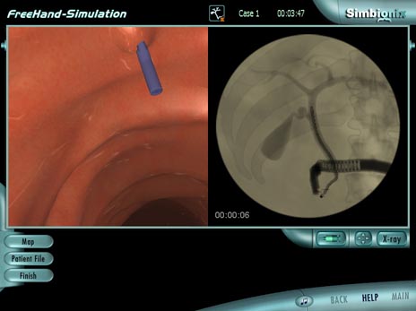 GI Mentor - GI Endoscopy Simulator